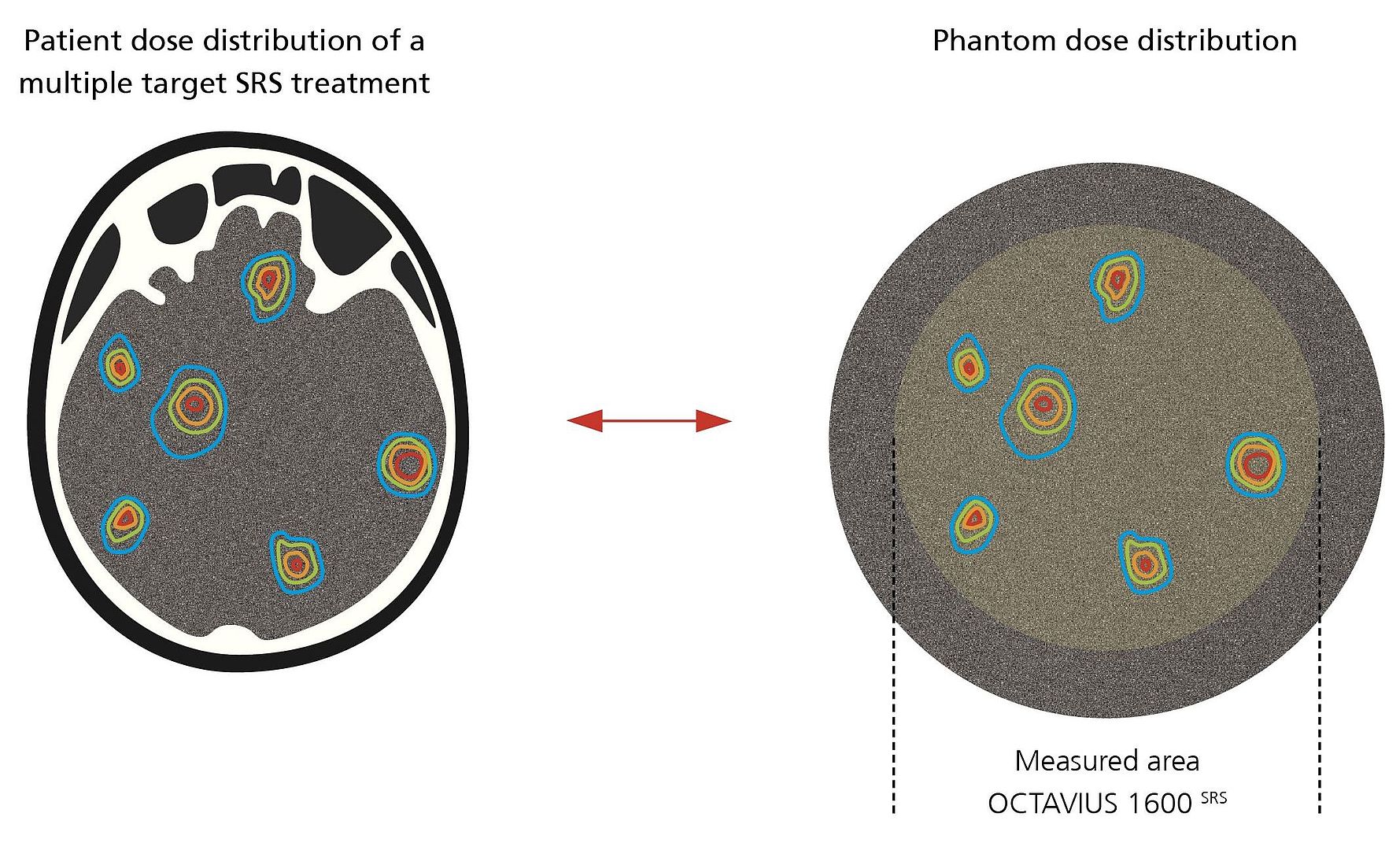 OCTAVIUS Detector 1600 SRS - PTW Freiburg GmbH